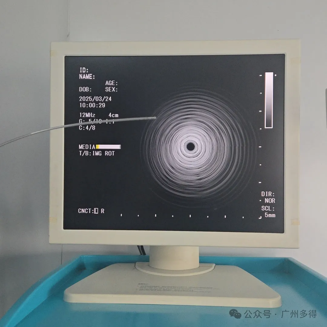修超声内镜大小探头送EBUS/EUS应用培训 - 网站